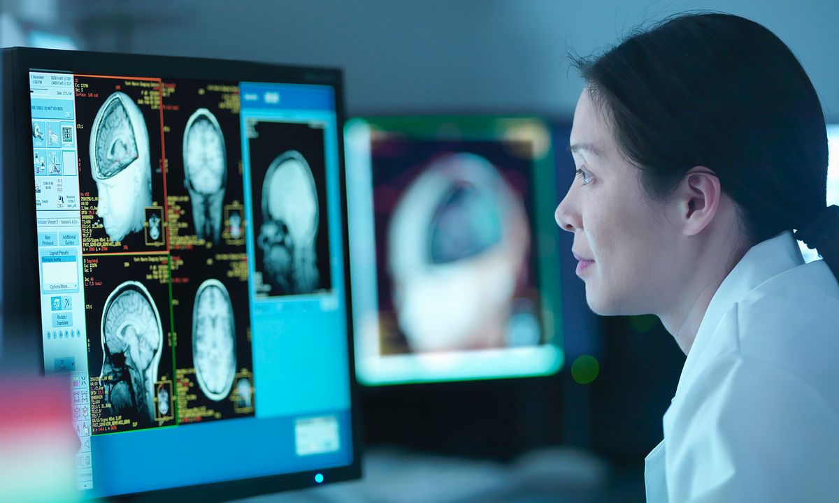 The Ultimate MRI Quiz | HowStuffWorks