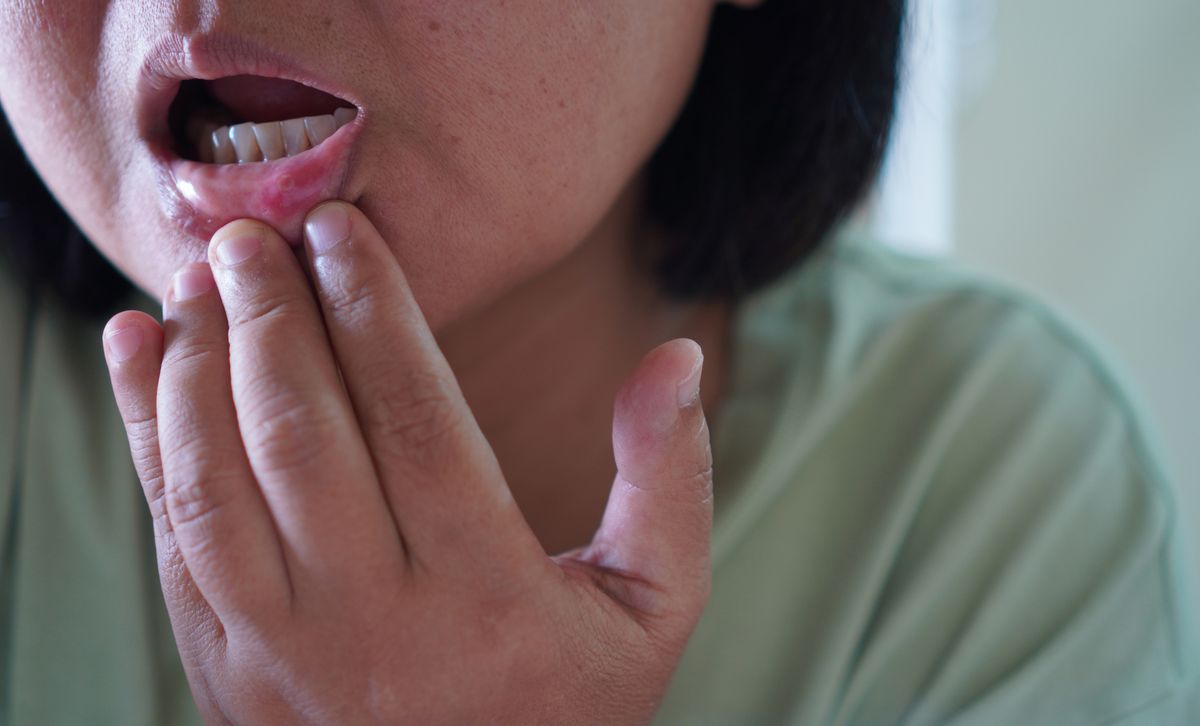 Dream Interpretation: Teeth Falling Out – Meaning & Common Reasons ...