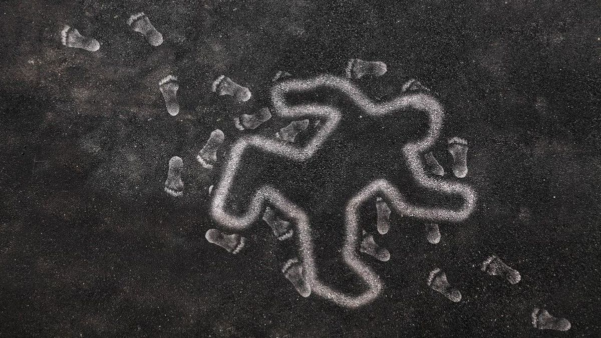 Are You a Pushover? | Zoo