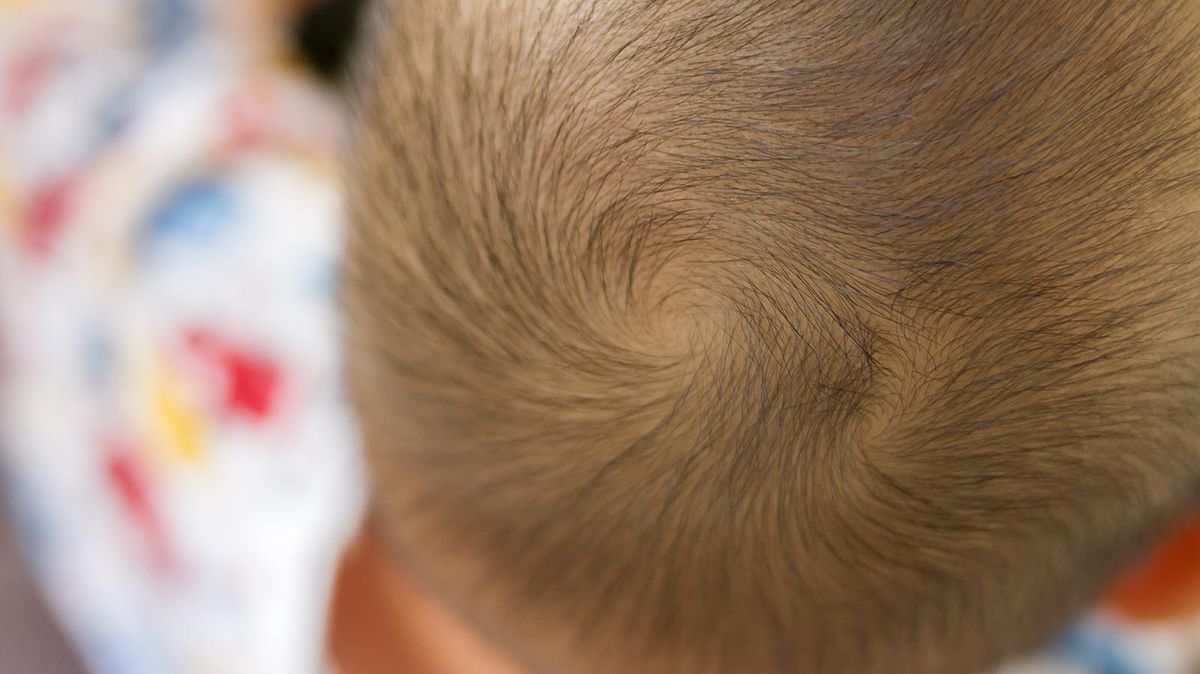 Got a Cowlick? Hair Styling Doesn't Have to Be Impossible | HowStuffWorks