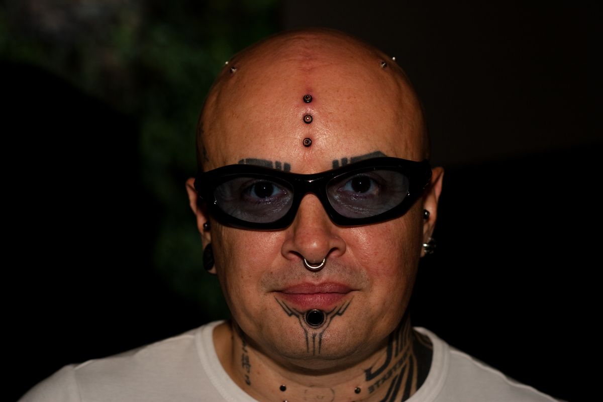 How Transdermal Implants Work | HowStuffWorks