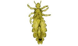 5 Parasites That Breed On and In Your Skin | HowStuffWorks